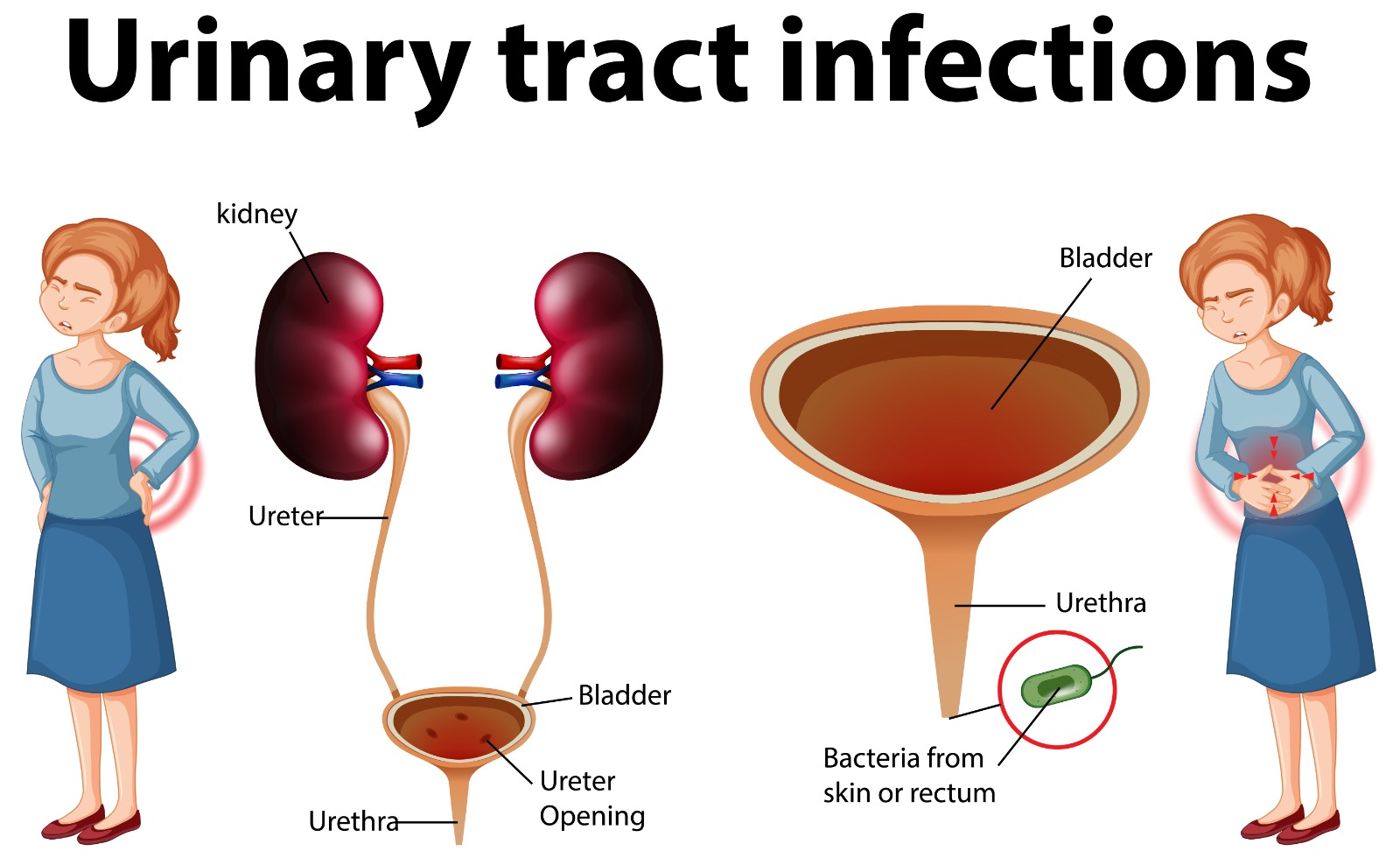 UTI Infection Treatment: Complete Guide to Causes, Symptoms & Prevention